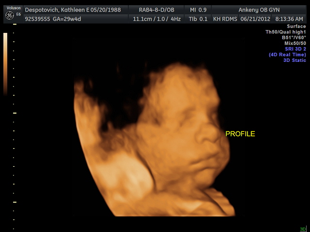 Pieces of Me: 30 week ultrasound pictures of Nadia