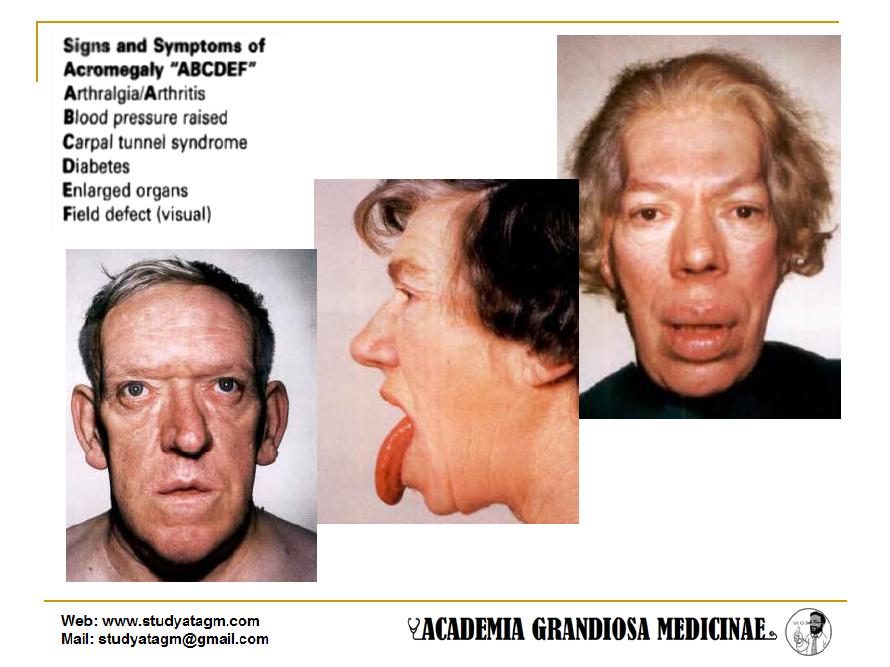 Dr.Harii's Case Discussions & Differential Diagnoses