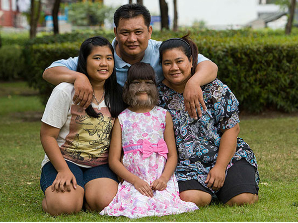 tayland'da yaşayan 13 yaşındaki kurt kız - ekşi sözlük