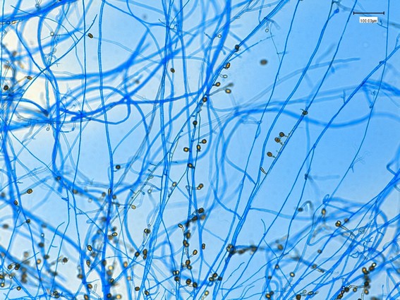 Fun With Microbiology (What's Buggin' You?): Stemphylium species