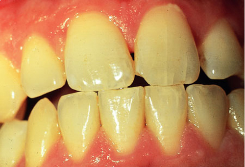 Dentistry and Medicine: Dental Trauma-Paediatric Emmergency Department ...