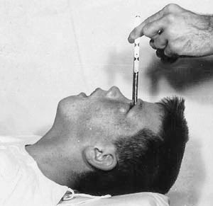 Mental Hospitals : History of a Lobotomy
