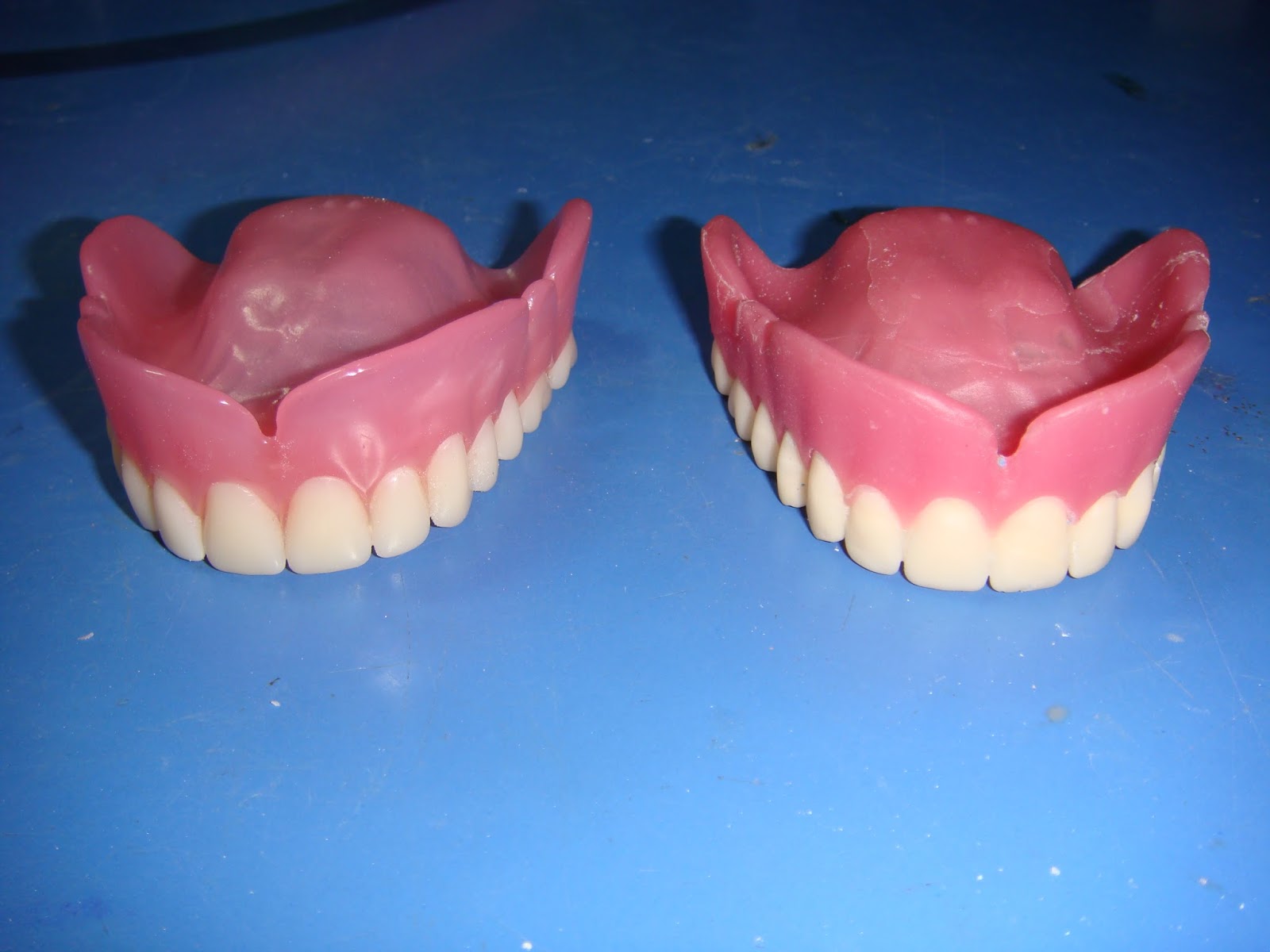 Understanding Prosthodontics - Tagore Dental College & Hospital-By ...