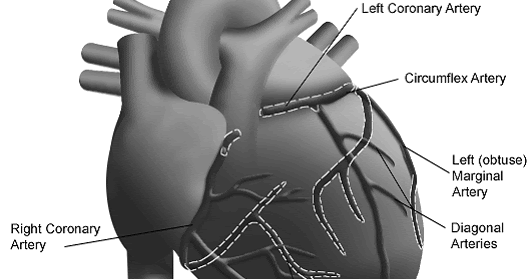 Infark Miokard Akut (AMI) ~ Informasi Kedokteran Dan Kesehatan