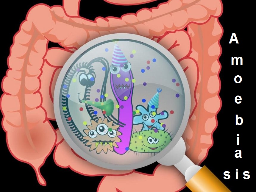 Laxmi Homeo Clinic: Amoebiasis treatment and remedies