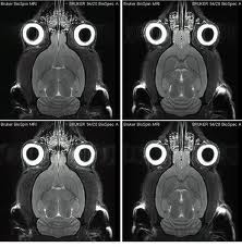 Incorporating MRI Parallel Imaging Technologies