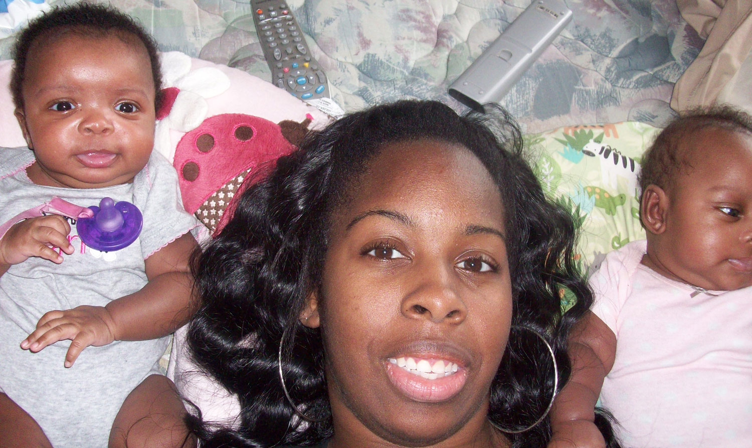 Preemie Twins and Me: What are Sunset Eyes?