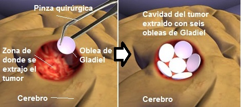Polianhídridos | Tecnología de los Plásticos
