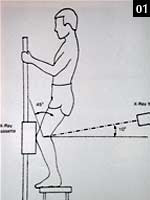 DICAS DE RADIOLOGIA - Tudo Sobre Radiologia: TÉCNICAS RADIOLÓGICAS - RX ...