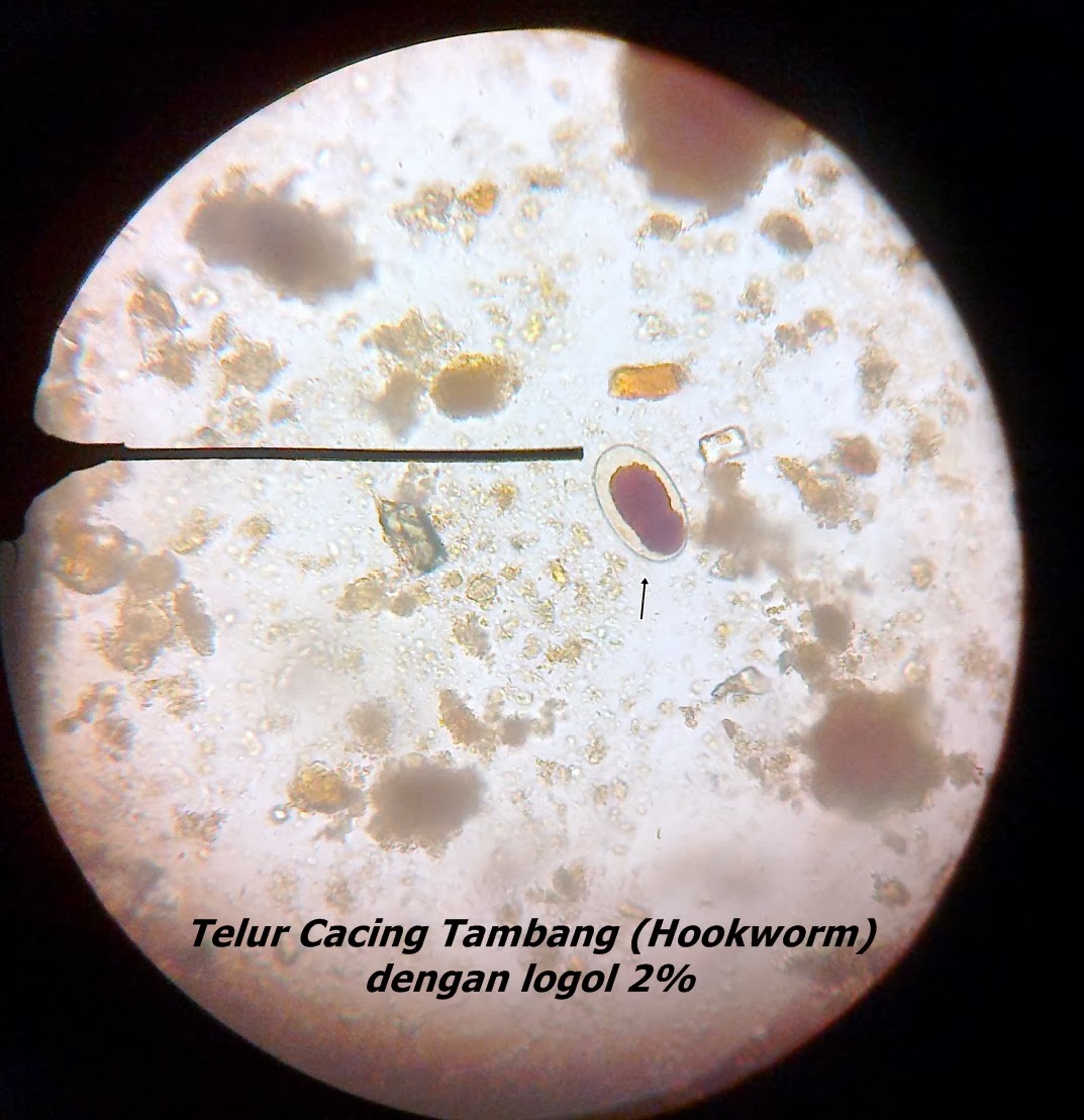 Rizqi Murtafi'ah: Pemeriksaan Telur Cacing Dengan Metode Teknik NaCl Jenuh