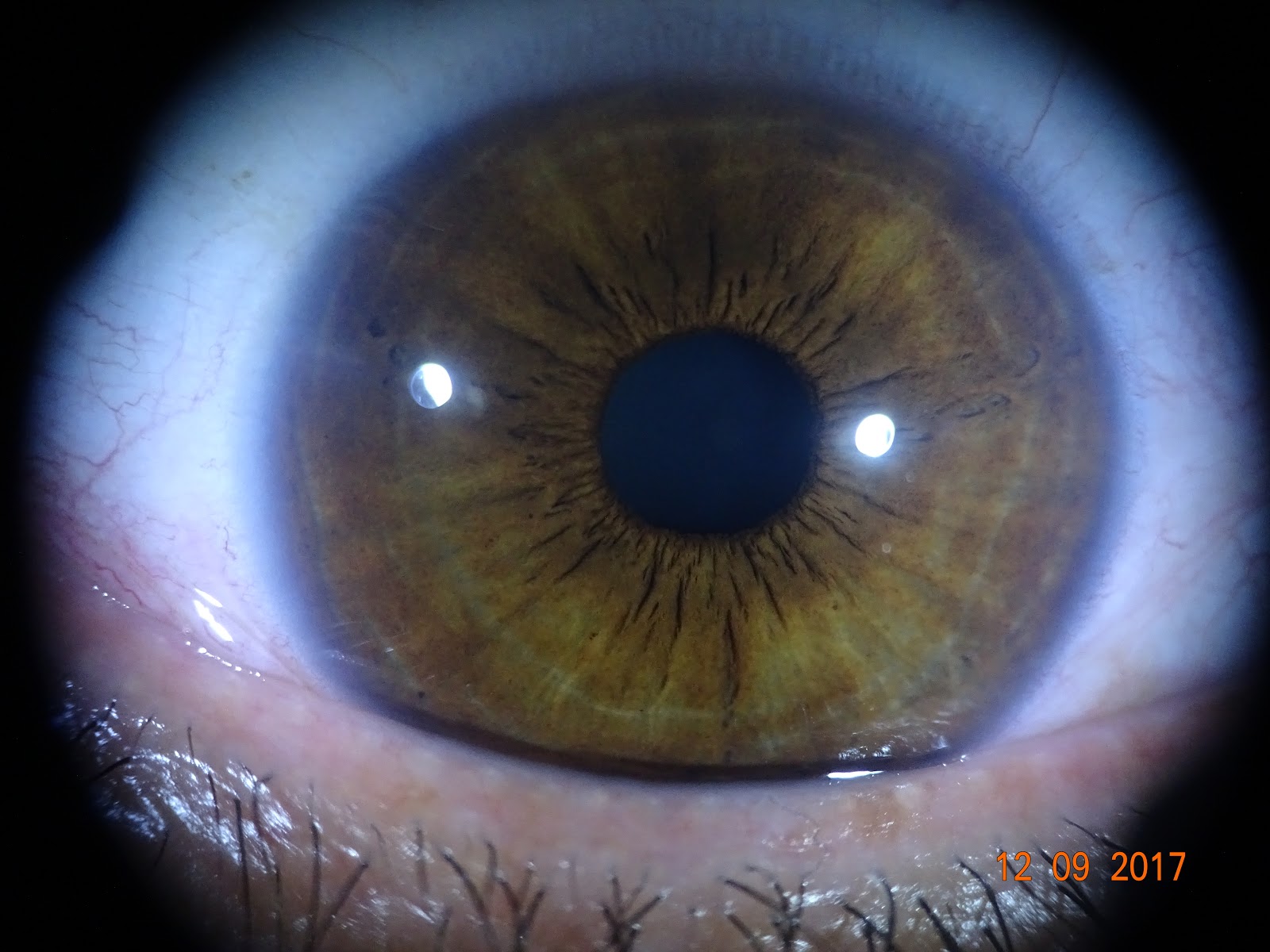 No Mundo da Íris: Azul, Castanha, Verde...Qual a cor dos seus olhos? Ou ...