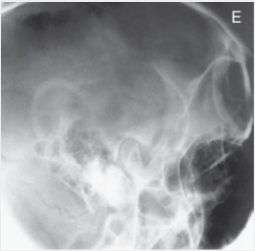 DICAS DE RADIOLOGIA - Tudo Sobre Radiologia: POSICIONAMENTO RAIO X DA ...