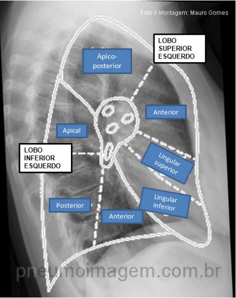 SALUDUCEBOL2011: ANATOMIA RADIOLOGICA