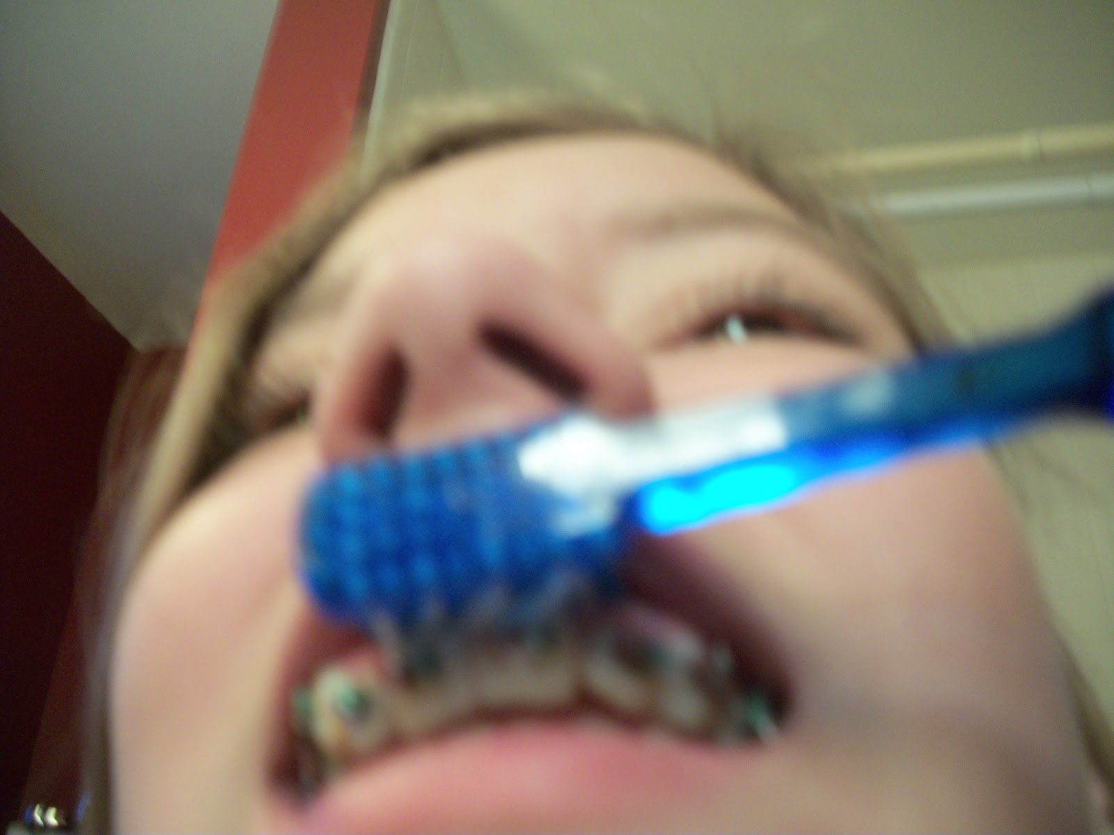 Life Through Ellie's Eyes: Braces