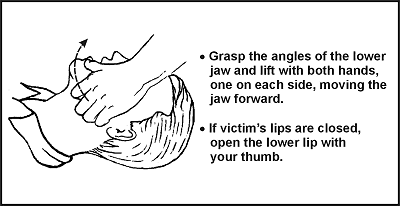 .kotak otak.: Basic Life Support / Basic Principle of CPR