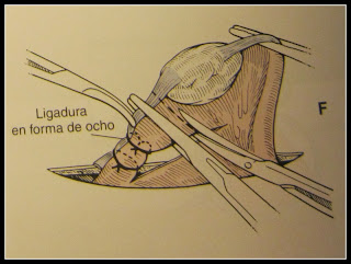 CIRUGÍAVET.ESTUDIANTE: OVARIOHISTERECTMÍA (OHE)