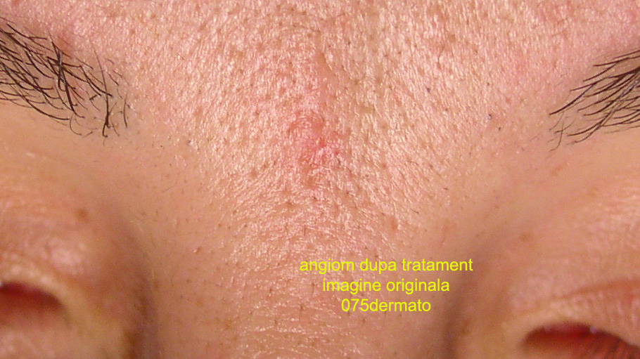 DERMATOLOGIA APROAPE DE TINE CABINET DERMATOLOGIE IASI DERMATOLOG ...