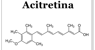 Bulário da Farmacêutica Curiosa: Acitretina (Neotigason)