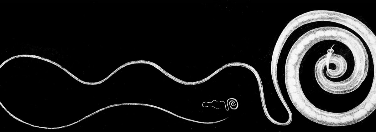 Infection Landscapes: Whipworm