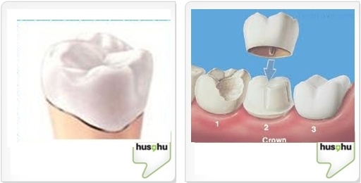 US Certified Dentist: Hus'hu Newyork Dental Clinic - What are ...