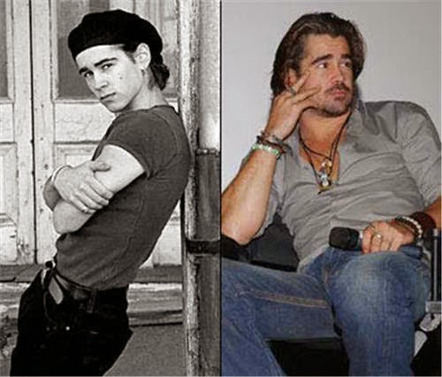 Colin Farrell Plastic Surgery