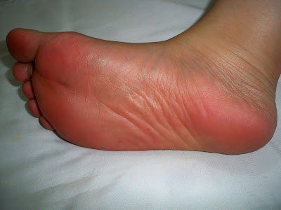 Oh's Beauty Rx --- Beauty Junkie: Lander Peppermint Pampering Foot Blush