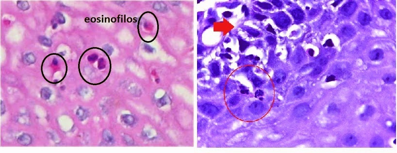 GASTROINTESTINAL AND LIVER HISTOLOGY PATHOLOGY ATLAS: ESOPHAGUS ...