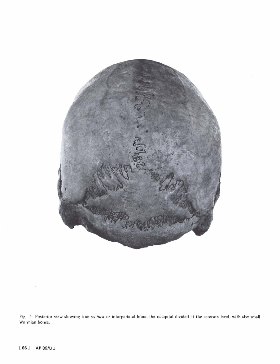 The Slope-Headed Ones: America's Original Tribe?