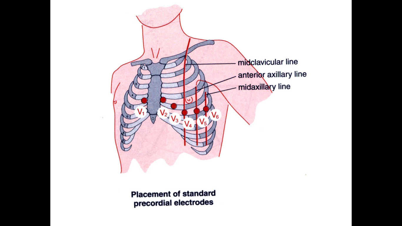 SAYANGI JANTUNG KITA: SADAPAN ECG, EKG