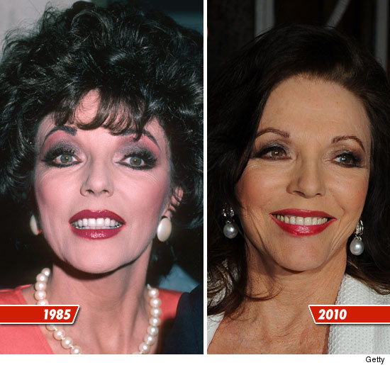 Joan Collins Botox Plastic Surgery Before and After - Star Plastic ...