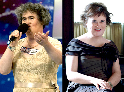 Susan Boyle Plastic Surgery Before and After Facelift and Chin Implants