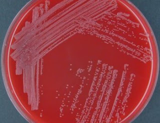 YERSINIA SPP. - Microbiology Laboratory Turkey