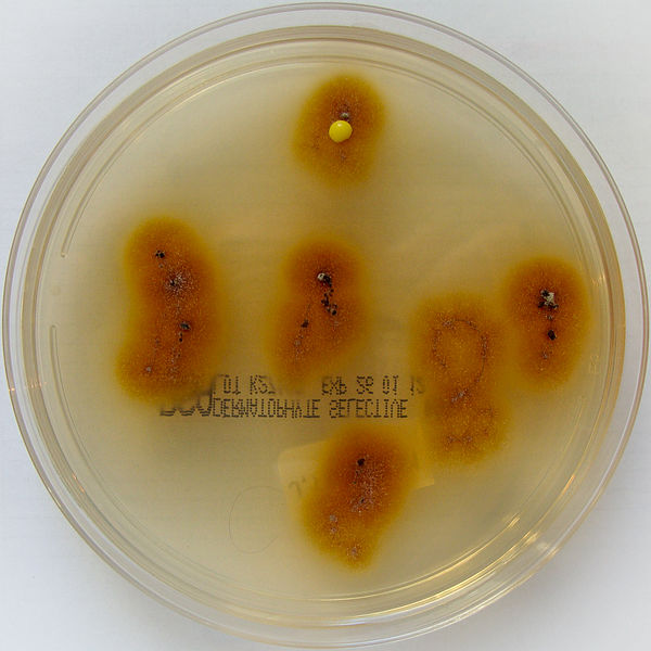 The Mycelium Connection: Fungal Word Friday: Anthropophilic