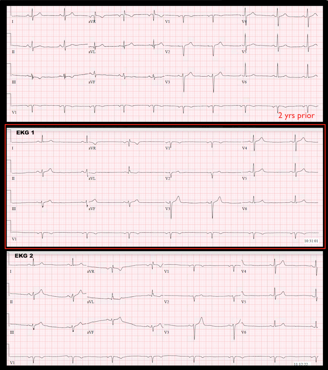 รายการ 97+ ภาพ Ekg 1 ช่องเล็ก คมชัด