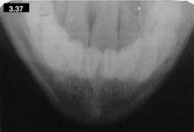 Radiología Oral y MaxiloFacial