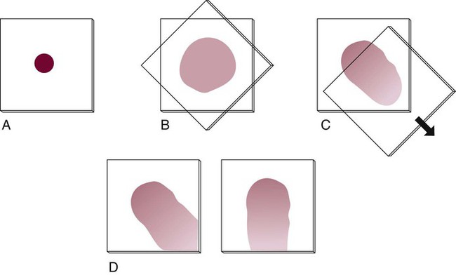 Lecture Notes in Medical Technology: Lecture #13: Morphological ...