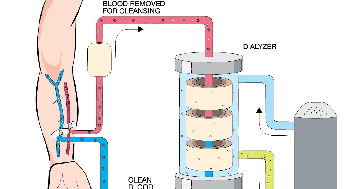 Singapore Web Listing: The Kidney Failure Causes| Risk Factors | Lucenxia