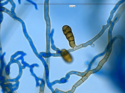 Fun With Microbiology (What's Buggin' You?): Pithomyces species
