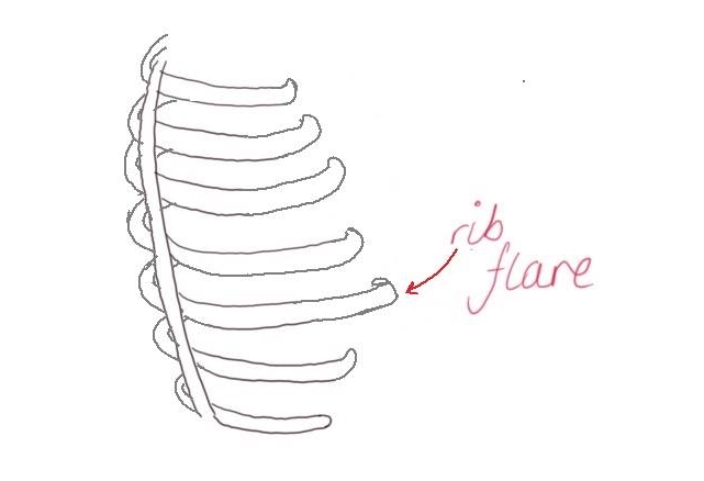 Rib Cages and Bra Fitting - a Masterpost