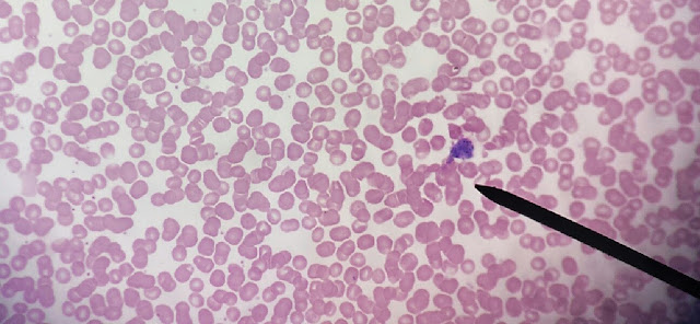 Histology: Blood Smear: basophil, eosinophil, and a plethora of ...