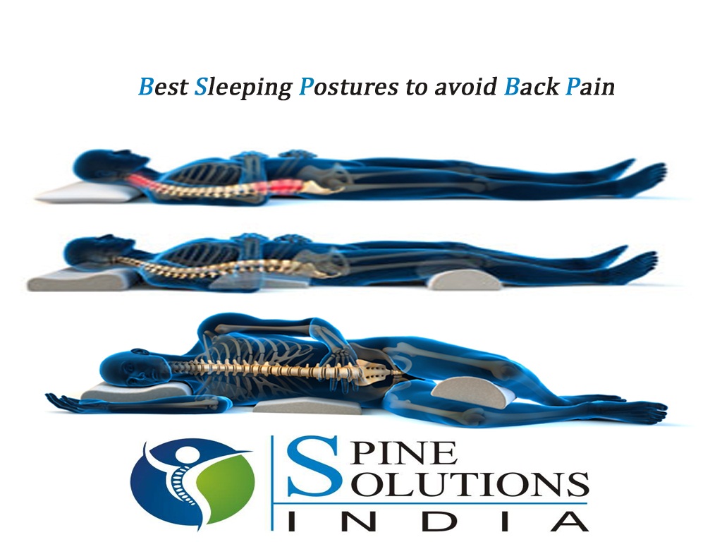 Spine Solutions India by Dr Sudeep Jain: Best Sleeping Postures