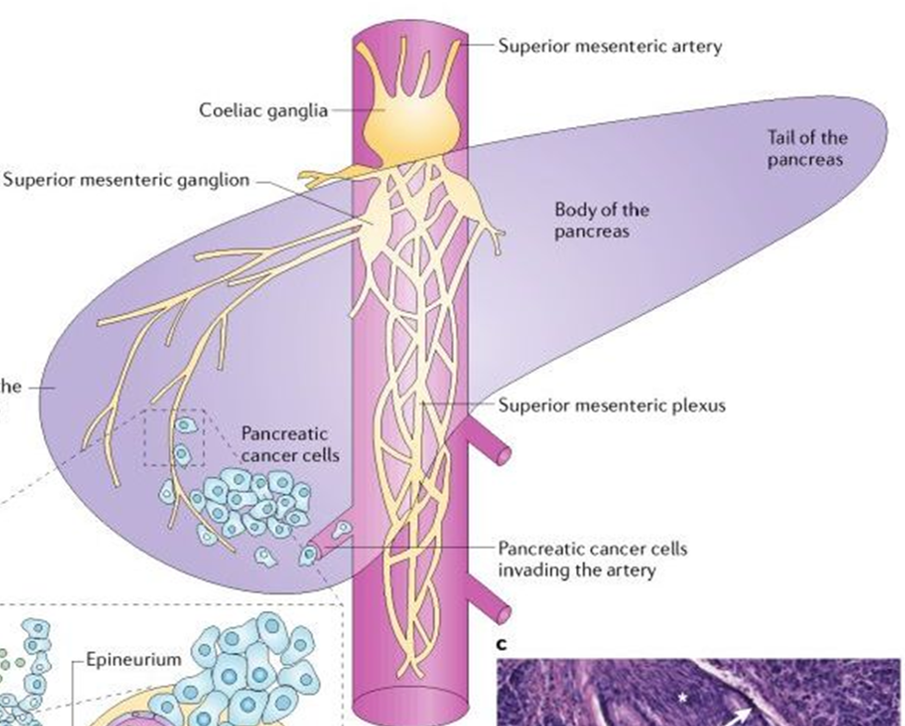 easyhumanatomy: summary of Celiac plexus : easy and simple way