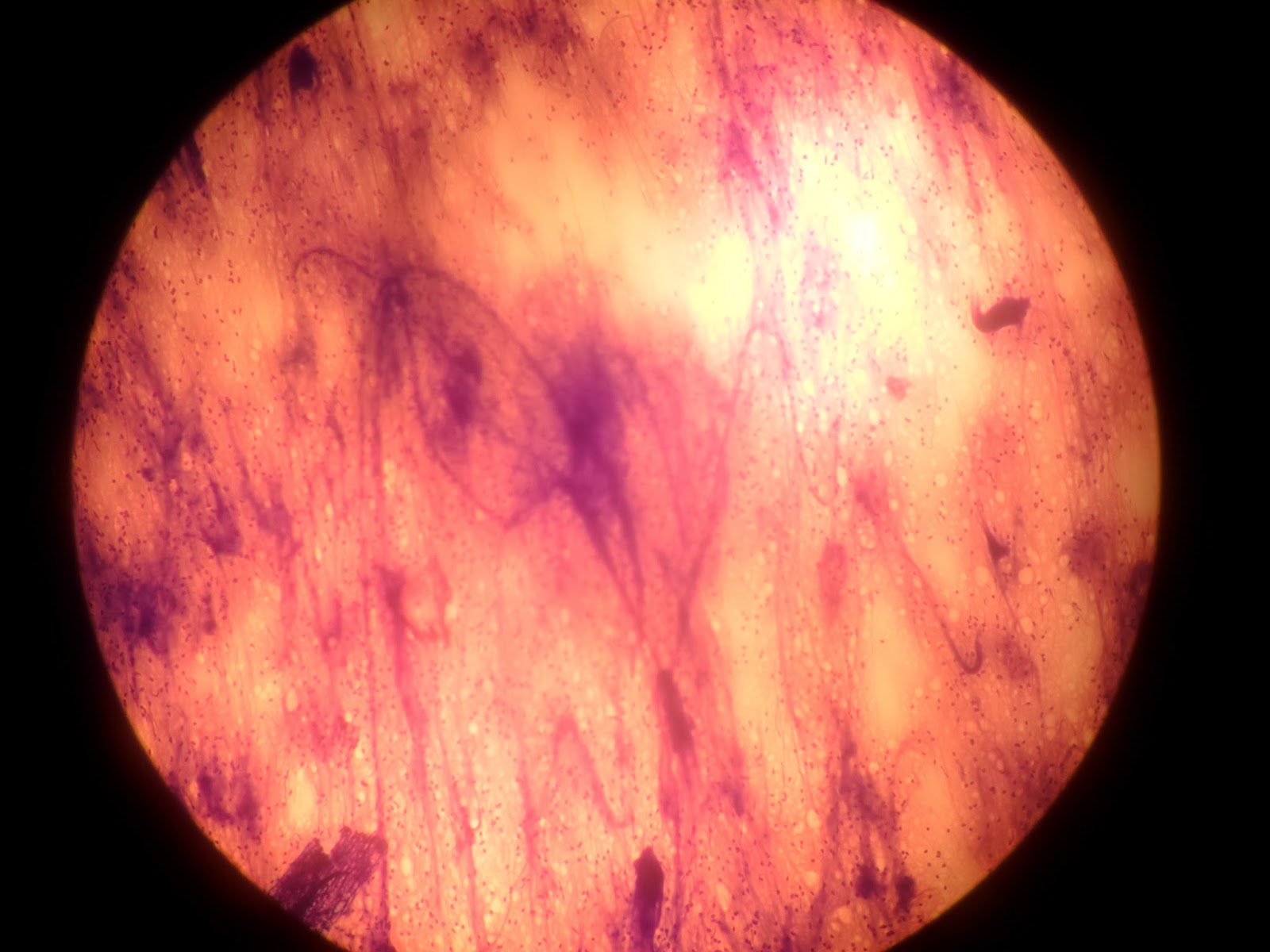 Ourlad's Paradigm: Nervous Tissue