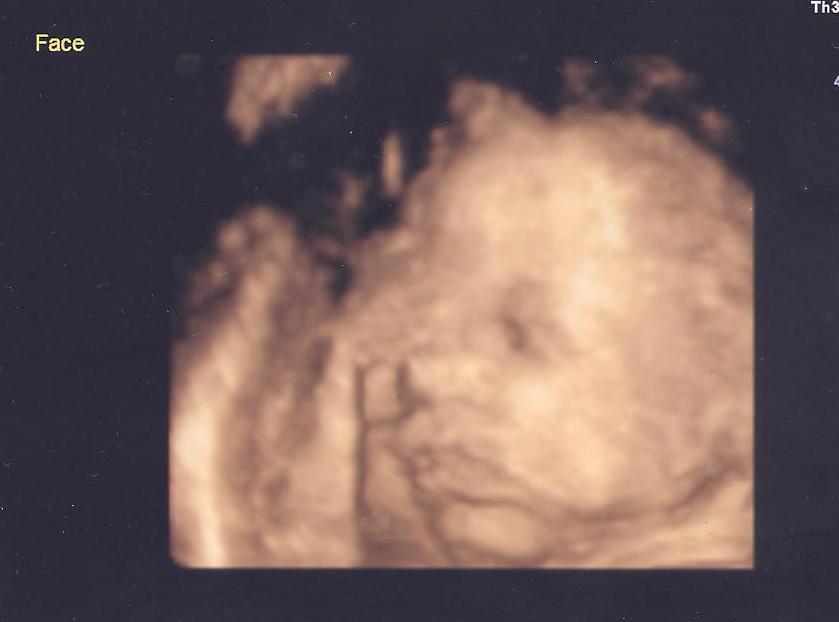 The Growing Gilberts: 33 Week Ultrasound