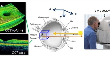 The Site for Healthcare Professionals: Optical Coherence Tomography (OCT)