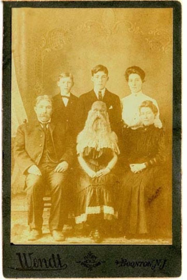 Amazing Vintage Photographs of the 'Minnesota Woolly Girl' Alice ...