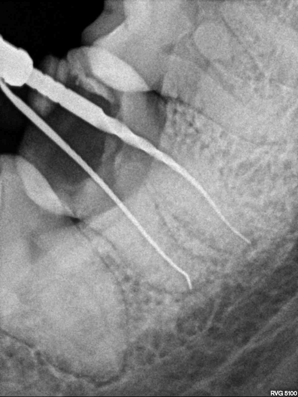 Restorative Dentistry & Endodontics