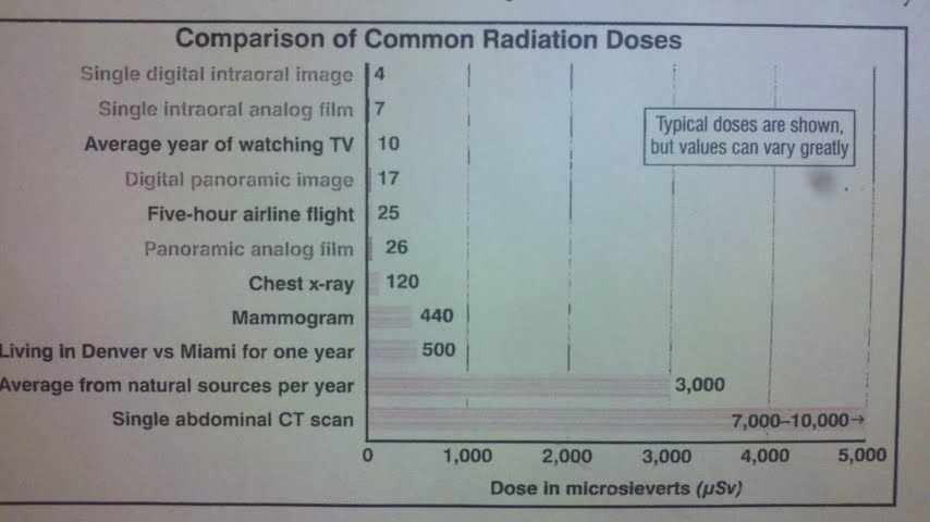Dental Innovations: Dental X-Rays