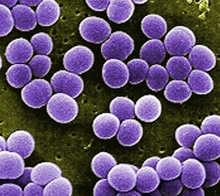 INFECTIOUS DISEASE: Coccus or spherical shaped bacteria