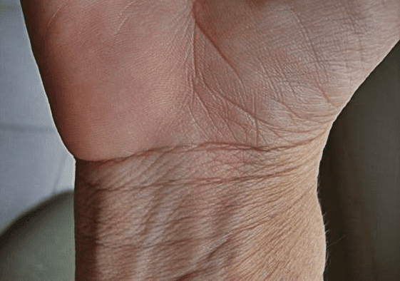 Things you might never knew had names as well.